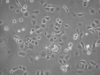 OVSAHO Human High-grade Serous Ovarian Cancer Cell Line | SCC294
